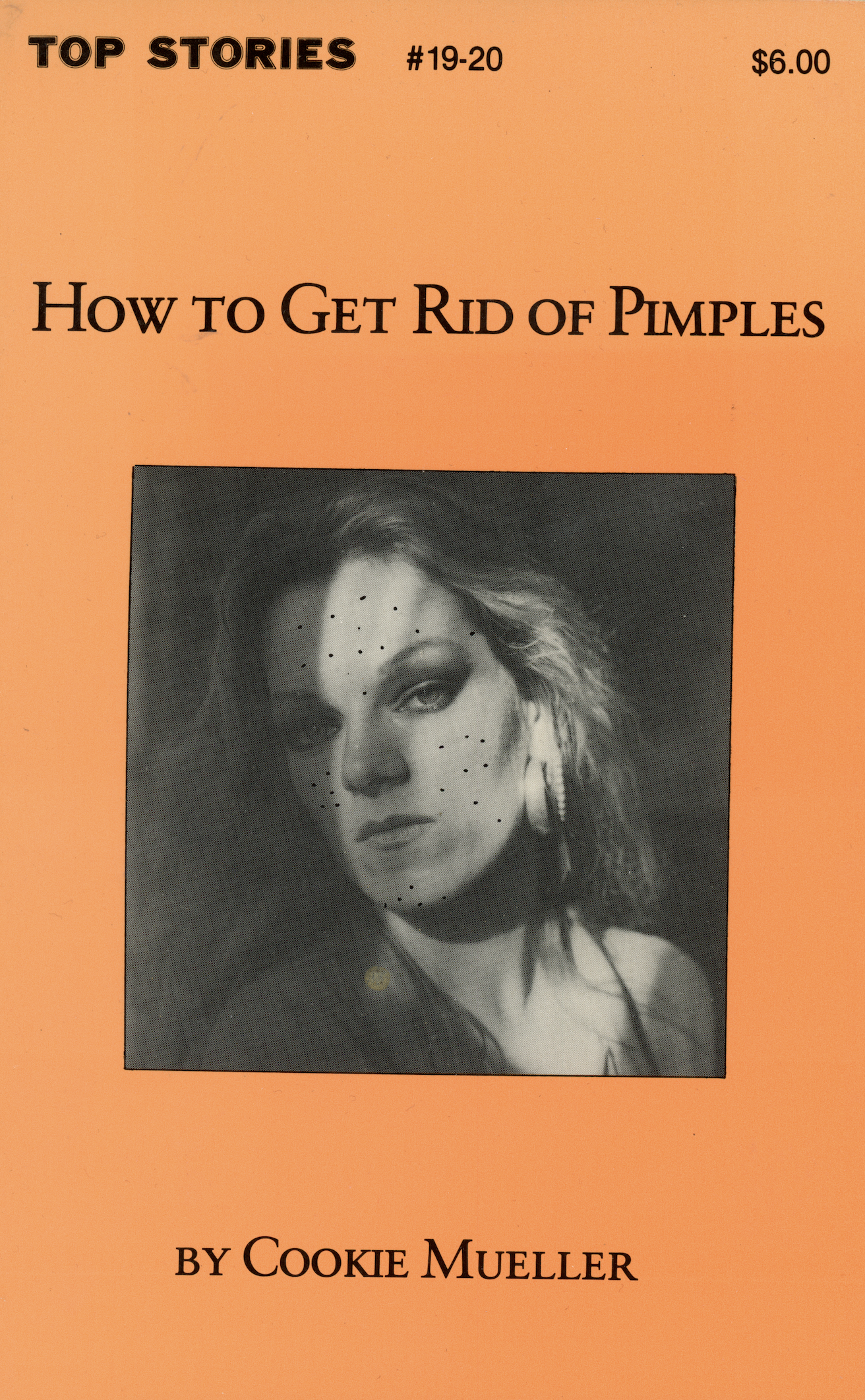 Gallery 98 | Cookie Mueller, How To Get Rid of Pimples, with ...